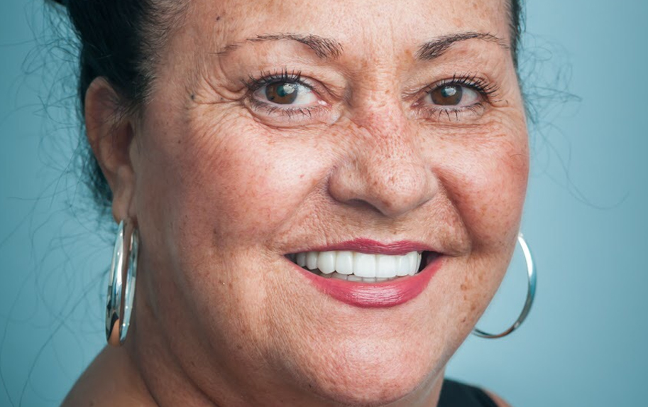 Smile Makeovers by Dr. Colucci: Before & After Photo Gallery